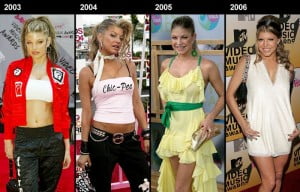 Fergie Plastic Surgery Before and After Photos Revealed