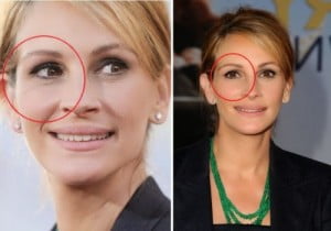 Julia Roberts Plastic Surgery: Is the Pretty Woman All Natural?