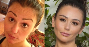 Jennifer Aniston Plastic Surgery Before and After Photos