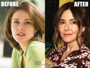 Christa Miller Plastic Surgery - Rumor or Truth?
